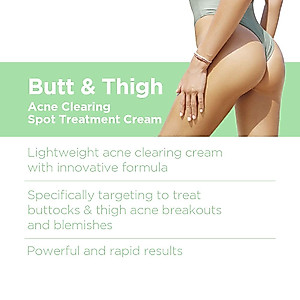 Butt Acne Treatment Cream in Tube Type | Travel Friendly | Clears Acne, Ingrown Hairs, Zits, Razor Bumps, Blackheads and Dark Spots for the Butt, Thigh and Other Sensitive Area | Prevents Future Breakouts