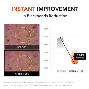 APRILSKIN Carrotene IPMP Hydromelt Cleansing Balm, 3.04 fl.oz, Noncomedogenic, Grapefruit Peel Oil, O-Cymen-5-Ol helps reduce blackheads & breakouts, for sensitive & oily skin, Korean Skincare