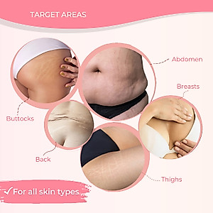 Levitural Stretch Mark & Scar Removal Cream for Pregnancy, Postpartum (2-in-1) - Maternity Skin Care Moisturizer Stretch Mark Prevention with Antioxidant Goji Extract - EXTRA LARGE Volume (8.8 Oz)