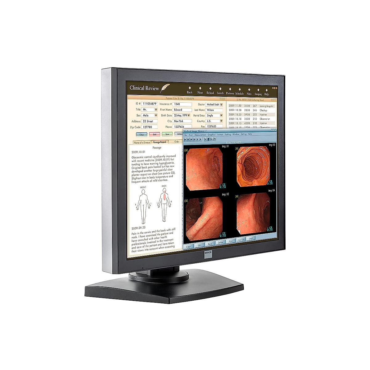Monitors Barco MDRC-1119 1MP 19" Color Clinical Review Display (K9301800A)