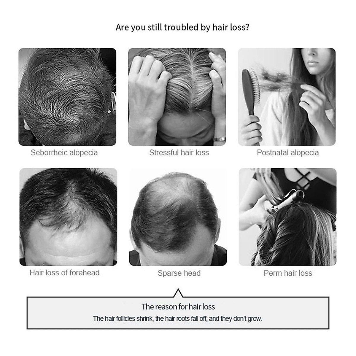 Hotiary Caffeine Hair Growth Shampoo, Hair Loss Treatment Shampoo Strenthen Hair Root Promote Hair Regrowth Thickness Activate Scalp 6.76 fl oz