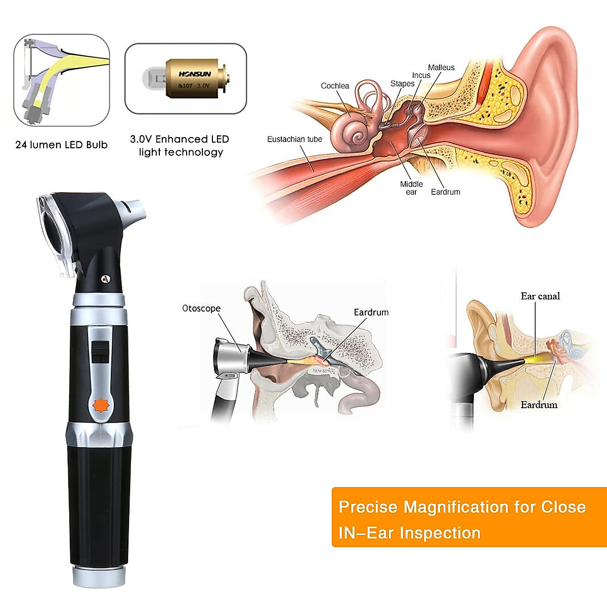 Otoscope Kit,Professional Diagnostic Ear Care Tool with 3.0V LED Bulb, 3X Magnification, 4 Speculum Tips Size - for Children, Adults, Pets, etc.