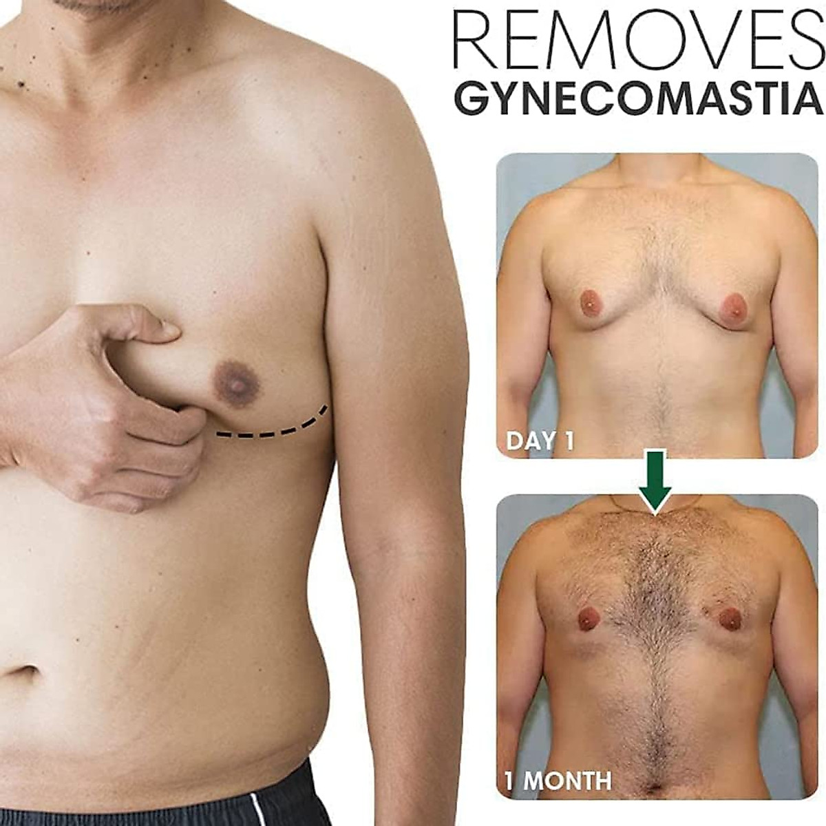 YCSM SoliPac Ginger Cream, Solipac Gynecomastia Tightening Ginger Cream,30 ml Ginger Fat Burning Cream Weight Loss Anti-Cellulite Slimming Cream for Men(2PCS)