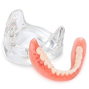 faruijie Overdenture Model - Implant Overdenture Model Lower Denture Model with Four Implants Dental Model Overdenture for Teaching and Studying