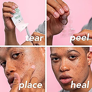 Mario Badescu AM/PM Blemish Kit, Includes Drying Lotion Spot Treatment with Salicylic Acid and Sulfur (1 Fl Oz) AND Drying Patch Facial Stickers, Invisible Pimple Patches (12 Count)