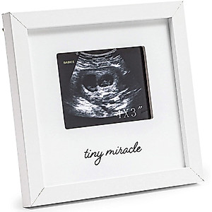 Juvale White Sonogram Keepsake Frame for 4 x 3 Ultrasound Photos (7 x 6.5 Inches)