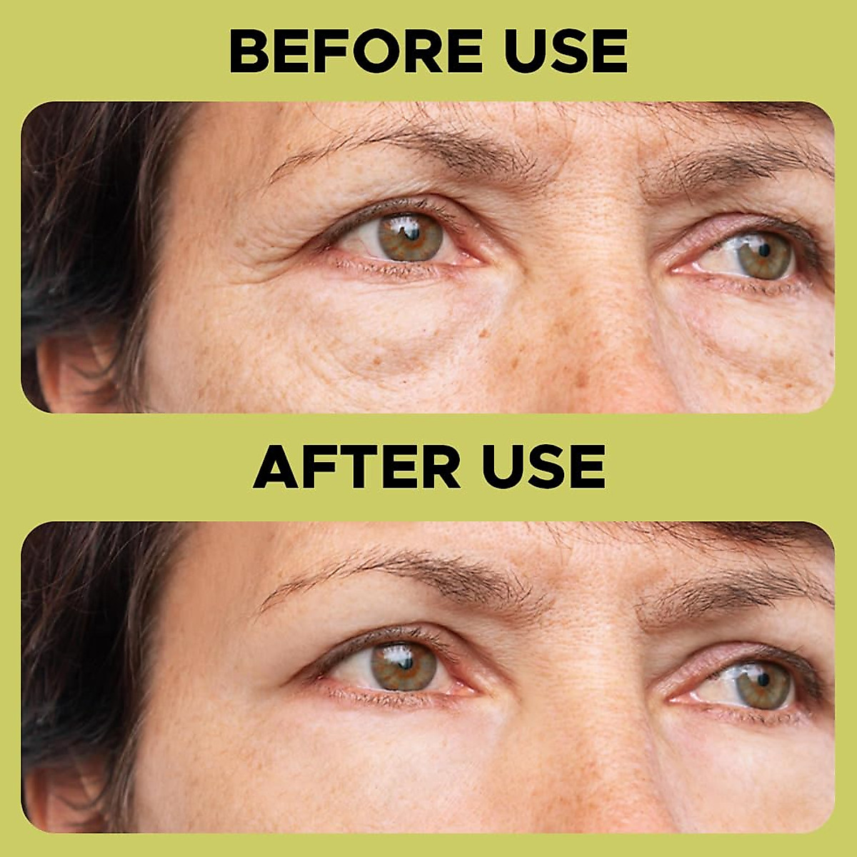 Swiss Botany Swiss Apple Stem Cell Serum for Face – Apple Stem Cell 3000 | Plant Stem Cell to Reduce All signs of Aging, Wrinkles, Discoloration, Restore Elasticity and Youthful Appearance, 1Fl Oz