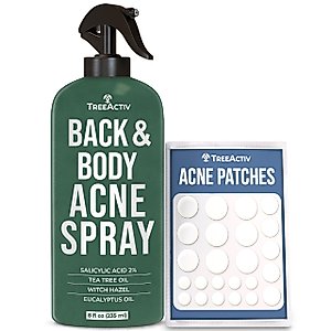TreeActiv Body Acne Treatment Spray, 8 fl oz, 2% Salicylic Acid Spray for Body, Back Acne Treatment Spray with Tea Tree Oil and Aloe Vera, Gentle Back Acne Spray that Clears Body Acne, 2000+ Uses