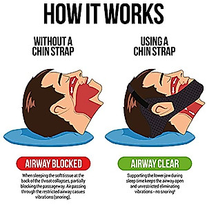 AVEELA Anti Snoring Chin Strap for CPAP Users | Large | Keep Mouth Closed While Sleeping | Adjustable Premium Snore Stopper Head Strap for Men and Women | Itch-Free Material for Uninterrupted Sleep