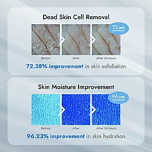 VILLAGE11FACTORY AHA 12% Body Lotion Korean Body Cream Exfoliating & Rejuvenating Formula with Glycolic Acid and Hyaluronic Acid Unscented (10.6 Oz)