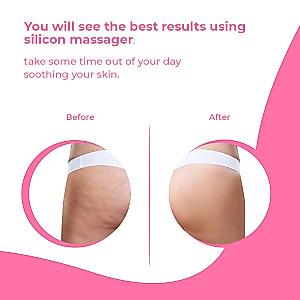 Cellulite Remover Anti Cellulite Massager Roller - Anticellulite Fascia Blaster for Cellulite Treatment - Improves Fat Deposits Use Cellulite Brush & Cellulite Roller with Cream or Oil