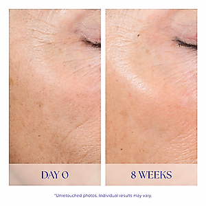 iS CLINICAL Active Peel System, two-step gentle at-home peel system for face Exfoliation
