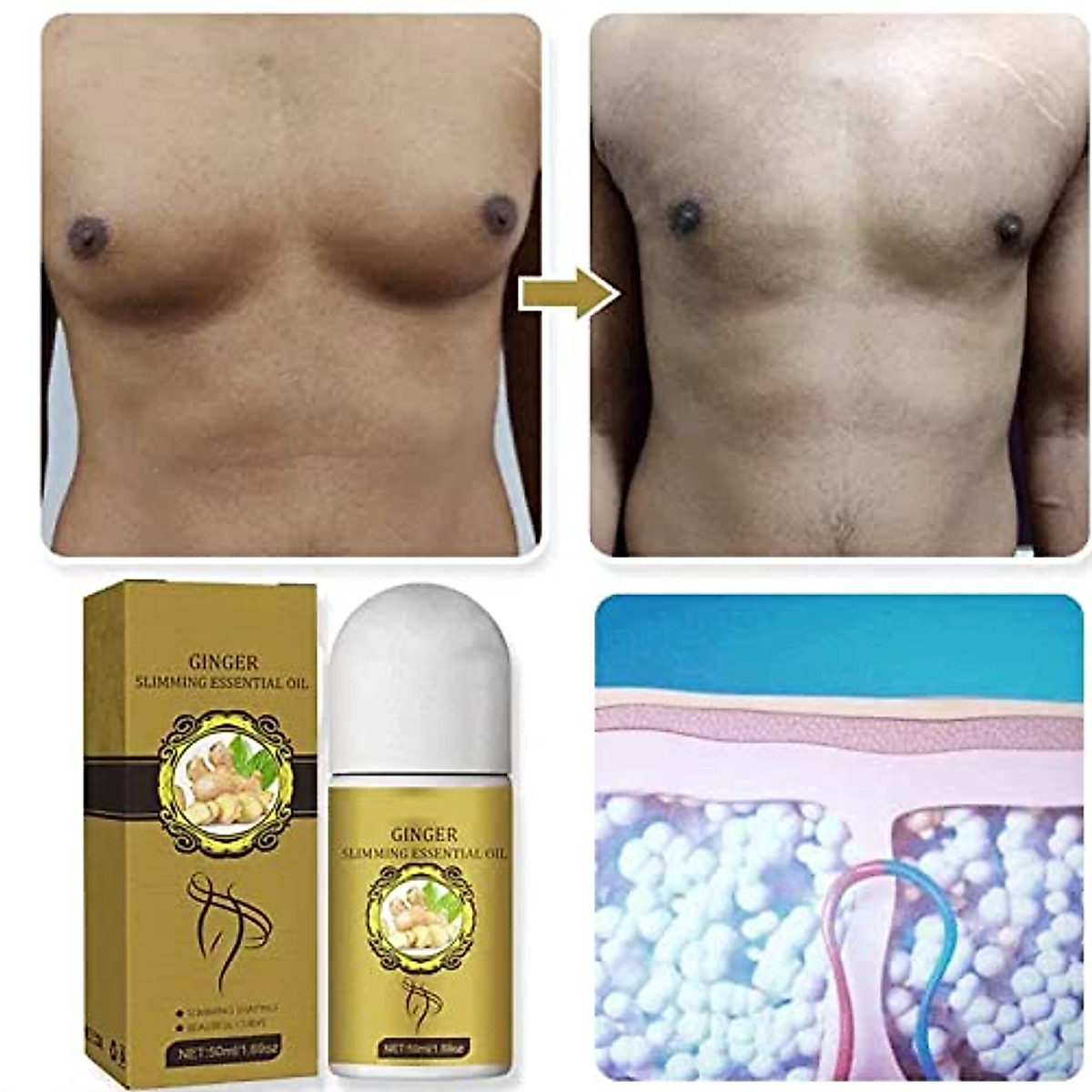 TURSHI Gynecomastia Firming Ginger Roller,2023 New Gynecomastia Tightening Ginger Cream,Firming Ginger Breast Firming Down Cellulite for A Better Physique Make Them Firmer Cleansing Oil