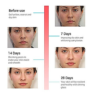 BREYLEE Rose Face Serum, Hydrating Serum Moisturizing Serum Face Serum Hydrating with Hyaluronic Acid Alcohol Free Facial Serum for Skin Care(17ml,0.6fl oz)