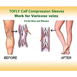 TOFLY® Calf Compression Sleeve for Men & Women, 1 Pair, Footless Compression Socks 20-30mmHg for Leg Support, Shin Splint, Pain Relief, Swelling, Varicose Veins, Maternity, Nursing, Travel, Beige XL