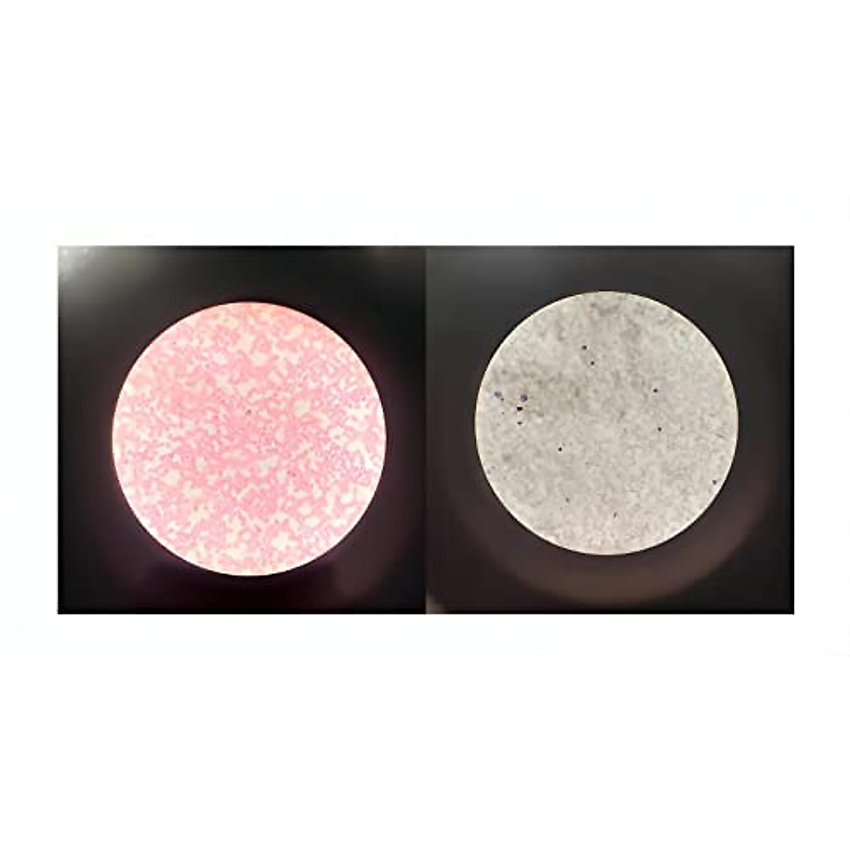 2pcs Human Blood Smear, HE Stain & Wright's Stain, for Observation of Red and White Blood Cells