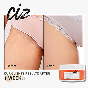 Bikini Area Exfoliator, Exfoliating Scrub for Bikini Area, Ingrown Hair Treatment for Bikini Area, Razor Bump Treatment for Bikini Area, Sugar Scrub for Bikini Area, Shaving Exfoliator Scrub for Women