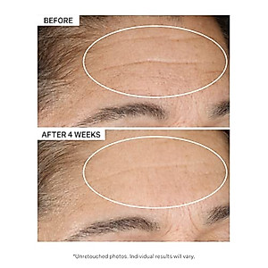 StriVectin Advanced Retinol Intensive Night Moisturizer, 1.1 Fl Oz