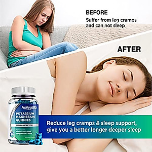 Potassium Magnesium Gummies, High Absorption Potassium Citrate 99mg Magnesium Citrate 180mg, Chewable Gummy Supplements for Leg Cramps & Muscle, 60 Count