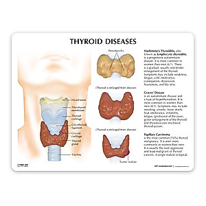 Thyroid Model Set | Human Body Anatomy Replica of Thyroid w/Diseases for Doctors Office Educational Tool | GPI Anatomicals