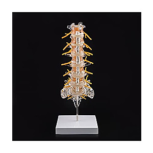 Ultrassist Human Lumbar Spine Model with Sacrum, Spinal Nerves and Herniation Disc, Includes Base for Display, Life Size Spine Model for Medical Education