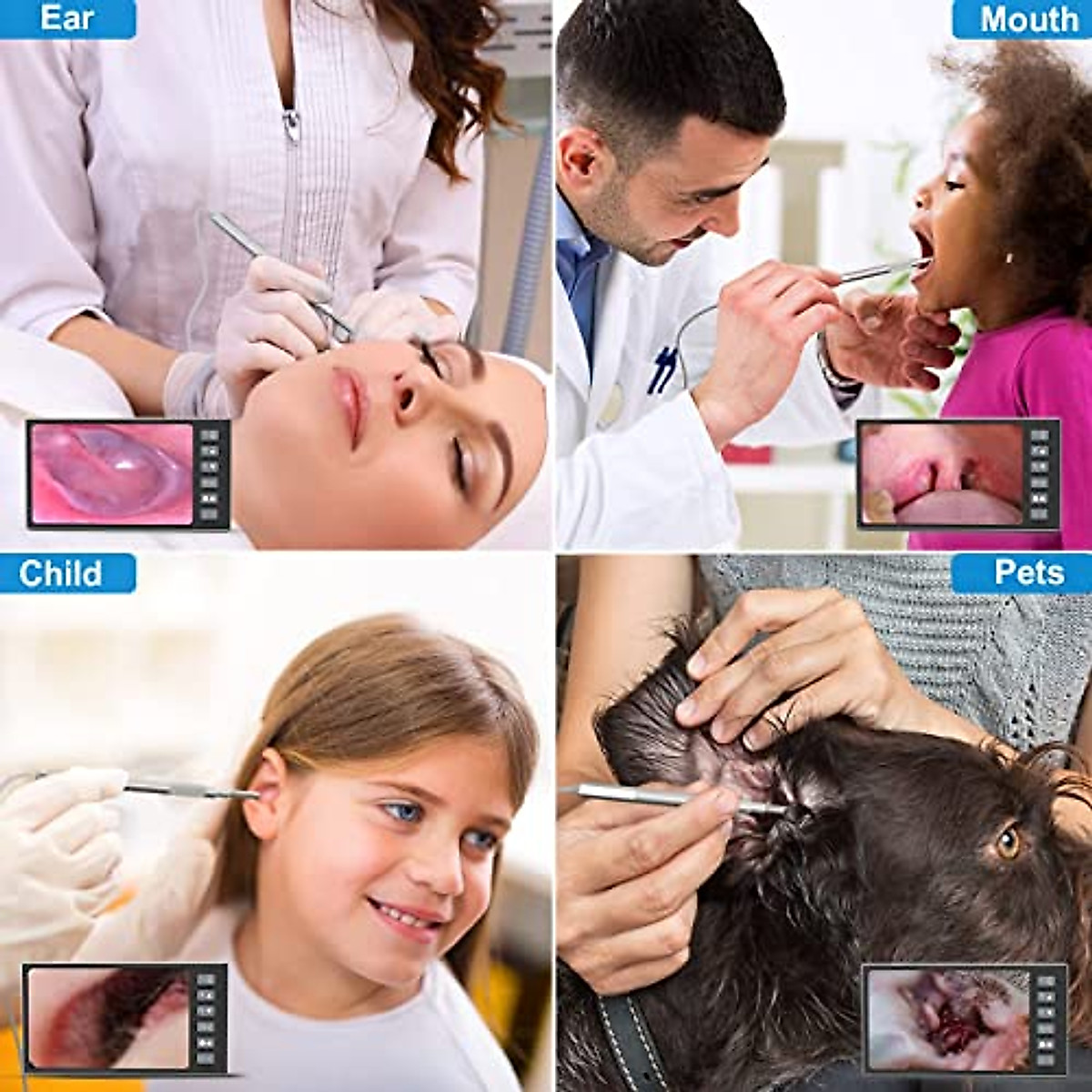 Digital Otoscope with 7 Inch IPS Screen, Hiacinto Ear Wax Removal Tool Camera, 3.9mm HD Ear Scope Otoscope with Light, Ear Camera and Wax Remover, Supports Photo Snap and Video Recording, 32GB Card