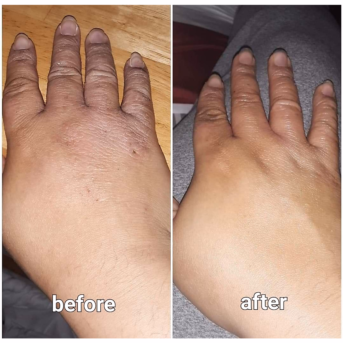 Amir'acle Body Butters & More Luxury Hydrating Cream for Dry, Itchy, and Irritated Skin - Infused with Organic Shea Butter, Calendula, Neem Oil, and Essential Oils (2 ounce)