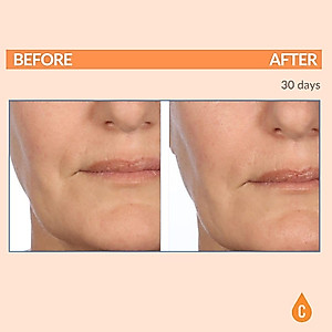 Serious Skincare - C3 Vitamin C Ester Protective Daytime Broad Spectrum SPF 30 Moisturizer - 2 oz. - Facial Cream - Sunscreen - Hydrating - Smoother Skin 2 oz.