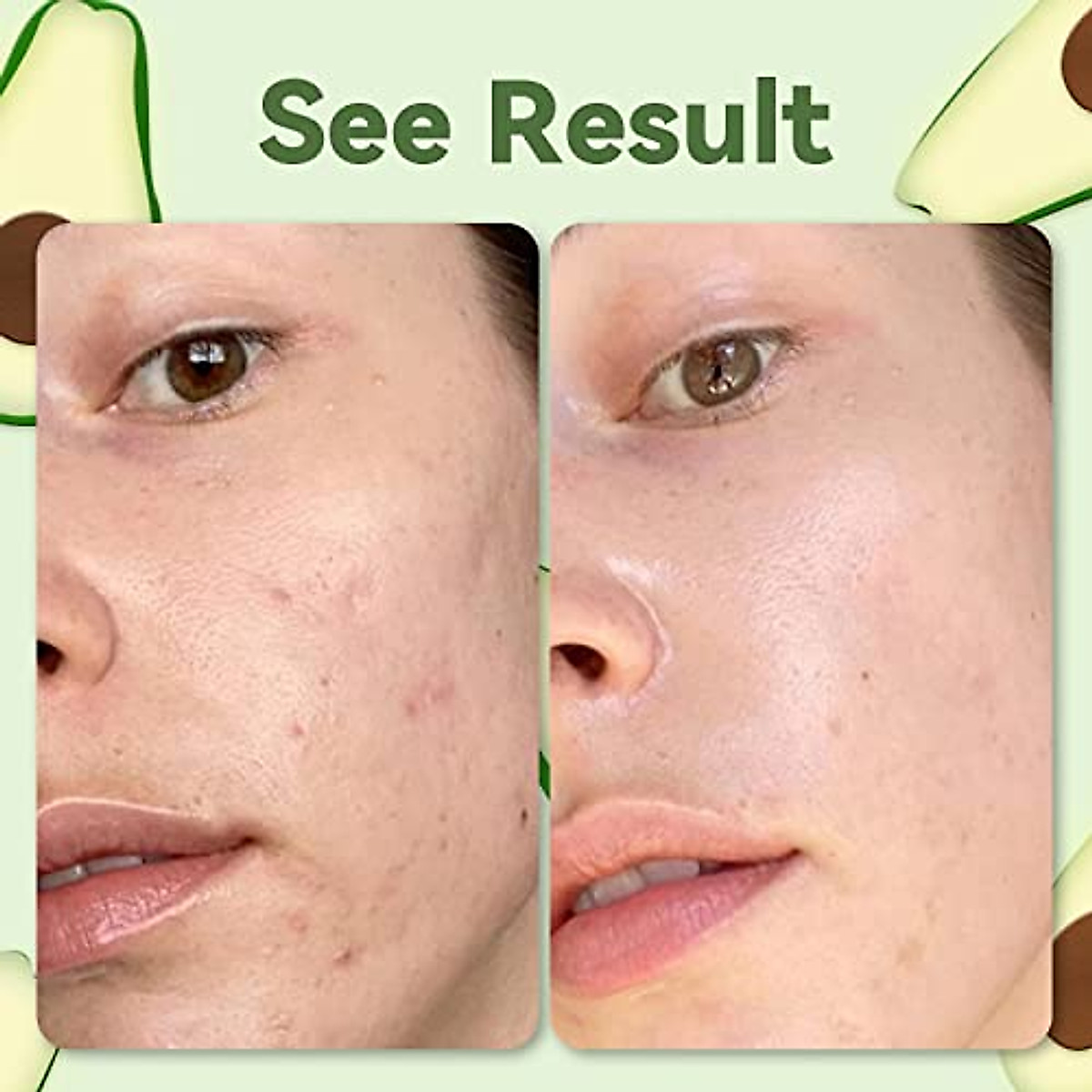 ANAI RUI Green Tea Face Mask with Avocado, Clay Facial Mask for Acne, Detox, Face Cleansing Mask, Hydrating, Nourishing, Soothing, 120g/4.23 oz