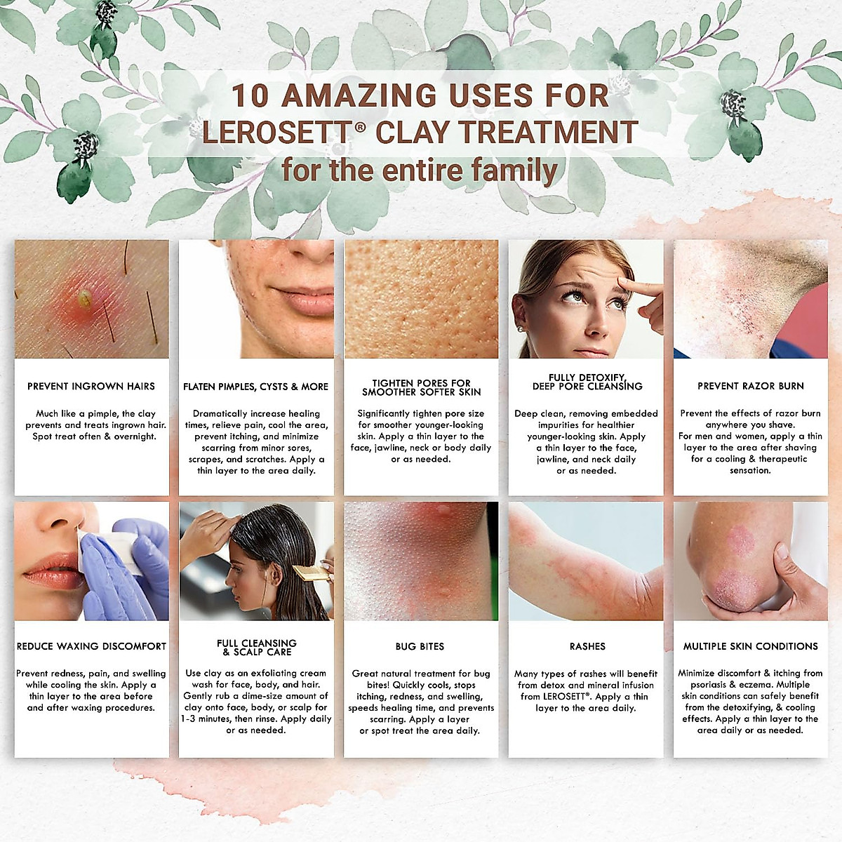 LEROSETT Facial Clay for Acne, Spot Treatment & Clay Mask, For Oily & Congested Skin, Reduces Blemishes, Blackheads & Pimples, Removes Ingrown Hairs, Tighten Pores, Vegan, 650+ Uses