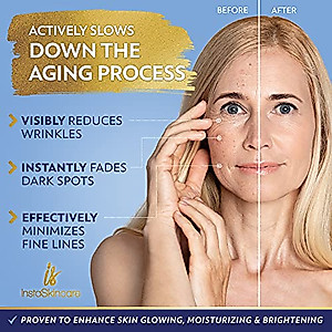 DOUBLE SIZED (2Oz) Niacinamide Serum for Face 10% with Zinc 1% Vitamin B3 Facial Serum Brightening Serum for Acne Pore Minimizer and Dark Spot Remover