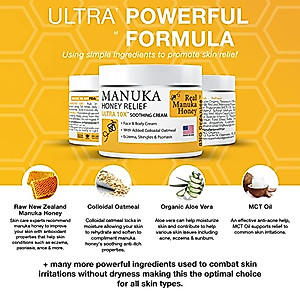 Manuka Honey Eczema Cream (2oz) Moisturizing Lotion Treatment Relief - Itchy, Dry Skin Healing Ointment - Skin-Soothing Moisturizer For Kids, Adults, Baby Body Mousse Honey Creme Eczema, Psoriasis