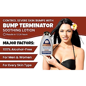 Bump Zapper Anti Bump Soothing Lotion
