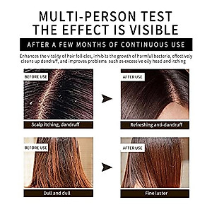 ONIYEA Natural Handmade Shampoo Bar Soap, Make Hair Soft And Glossy, Nourish Scalp, Replenish Hair Moisture, 100% Organic Plant Extract Hair Wash, Women Men, Eco-friendly 1.92 Oz Each Set of 2 (Peppermint)