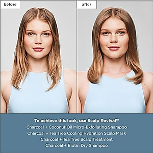 Briogeo Scalp Revival Soothe + Detoxify Minis Kit, Soothe a Dry, Flaky, Itchy Scalp, Clarify Build Up, Scalp Detox, Unclog Hair Follicles,Travel Kit, Vegan, Cruelty-Free, 4-Piece Set