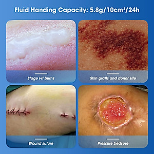Ourmed Hydrocolloid Bandages Large 4" x 4", Extra Thin Waterproof Wound Dressing with Adhesive for Light Exudate Wound, Blister, Acne, Superficial Wound Care, 0.5mm, 10 Pack, FSA HSA Eligible