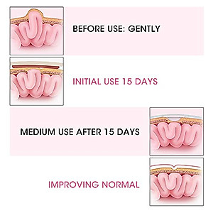 ZJchao Hernia Belt for Babies, 2-piece Hernia Belt Treatment For Hernia Therapy For Children Umbilical Hernia Belt for Newborns Infant Newborn Belt(Rosa)