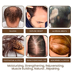 Rice Water For Hair Growth Shampoo Bar, 2 In 1 Fermented Rice Water Shampoo And Conditioner Bar For Hair Growth, Vegan Origin Growth Anti Hair Loss Rice Water Shampoo Bar, Solid Rice Bar Soap For Hair Growth All-Natural