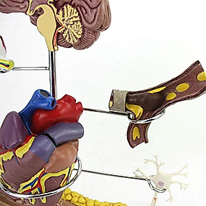 Teaching Model, Anatomy Model, Human Anatomy - Pathological Diabetes Model Diabetic Organ Anatomical Model, Complication Cerebral Pancreatic Neuron Surgery - Medical Educational Training Aid, 8 Parts