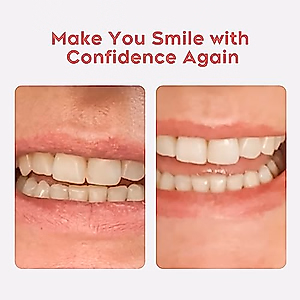 Dentures Fake Teeth DIY Kit Easy and Convenient DIY Fake Teeth Repair Missing Teeth or DIY Full Denture Kit Fake Teeth Top and Bottom Temporary Fake Teeth