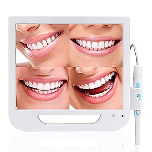 LVCHEN Camera with Display Screen - Remote Controller USB Digital Automatic Focusing Ergonomic Wired Camera 6 LED 10.0 Megapixel for Clinic