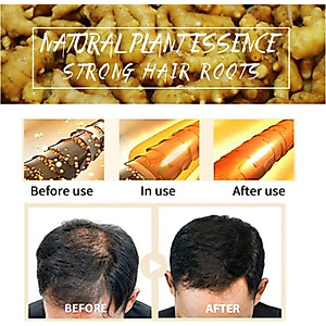 Ginger Hair Regrowth Shampoo Bars - Pack of 5, Promotes Hair Growth, Natural Organic Anti-Dandruff and Anti-Itching Ginger Soap