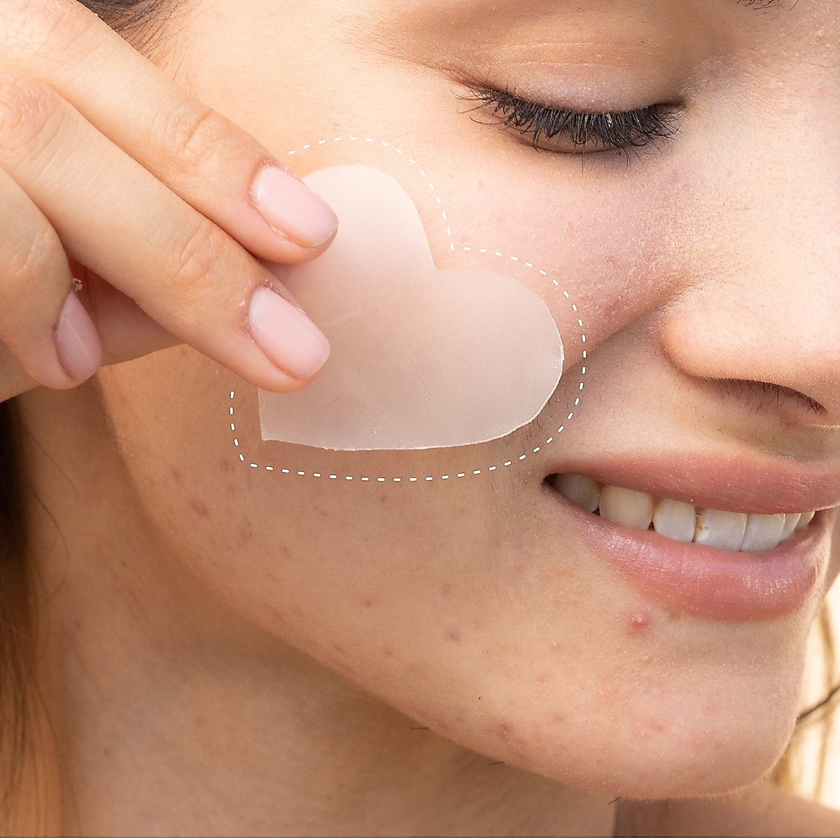 Hanhoo Custom Blemish Patch | Large Hydrocolloid Patches | for Face and Body Acne and Blemish Clusters | Customizable Pimple Patch Sheets | Cruelty-Free & Vegan | 2 Patch Sheet Count