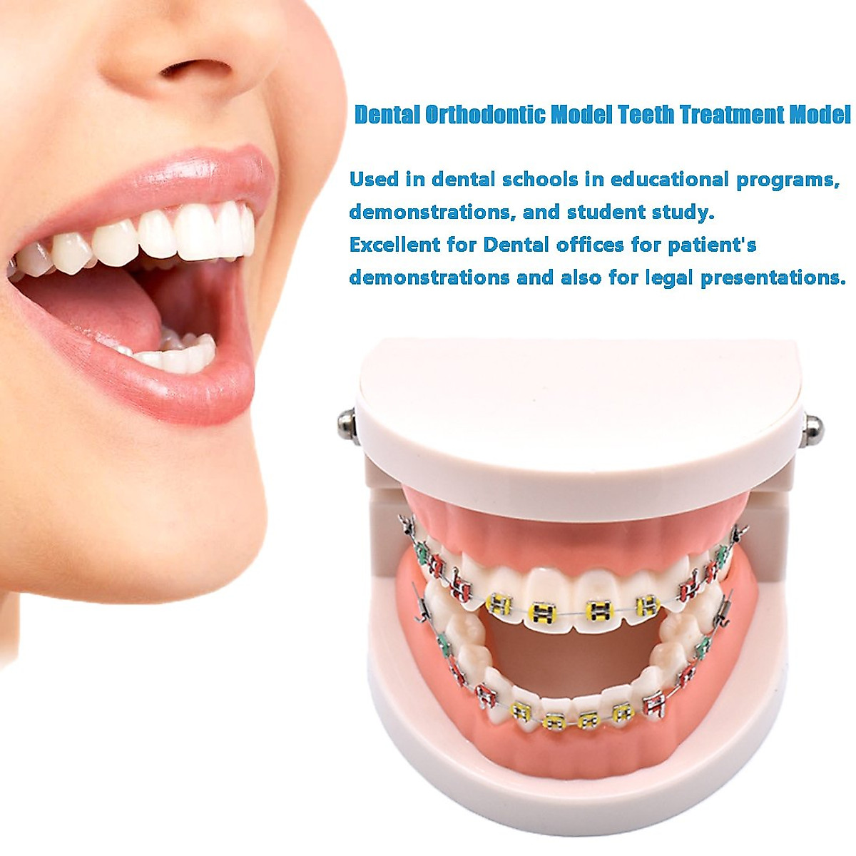 Angzhili 1 Piece Dental Demonstration Orthodontic Model with Metal Wires and Bracket (Metal bracket)