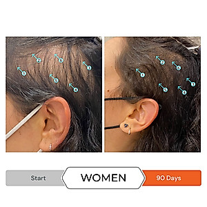 Revita Shampoo and Spectral.DNC-N Serum for Hair Thinning by DS Laboratories - Hair Thinning Bundle for Men and Women, Experience Fuller, Thicker Hair, Packaging May Vary (7 fl oz)