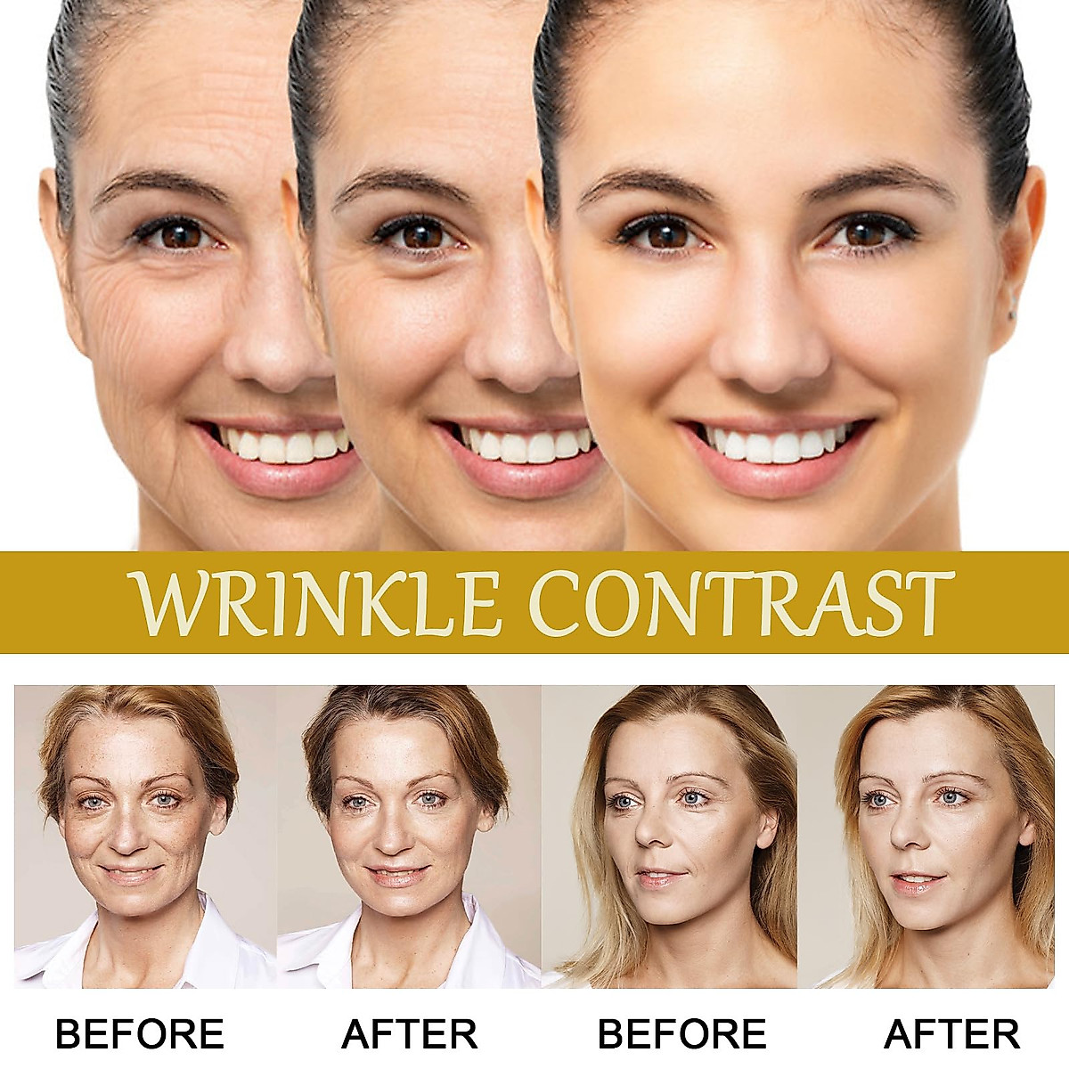 Vintesse Advanced Bee Venom Serum, Vintesse Bee Serum, Vintesse Serum, Vintesse Bee Venom Serum (1PCS)