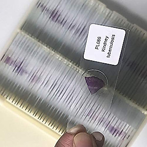 Human Pathological Section Prepared Tissue Specimen Slides 100pcs/box