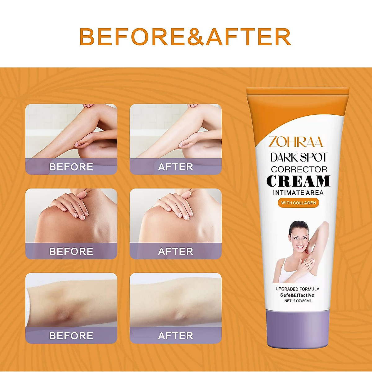 ZOHRAA Dark Spot Corrector Cream, Underarm Cream with Advanced Formula, Instant Results for Moisturizes Neck, Knees, Elbows, Armpit, and Private Parts - 2 fl. Oz