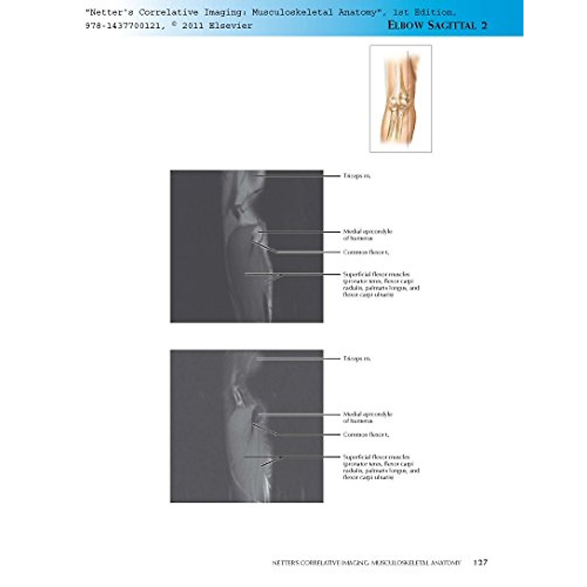 Netter's Correlative Imaging: Musculoskeletal Anatomy: with Online Access at www.NetterReference.com (Netter Clinical Science)