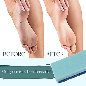 Mantello Pumice Stone for Feet- Foot Scrubbers for Shower and Foot Tub- Pumice Stone for Feet Callus Remover- Double Sided Foot Scrubber Dead Skin Remover- 4 Pack